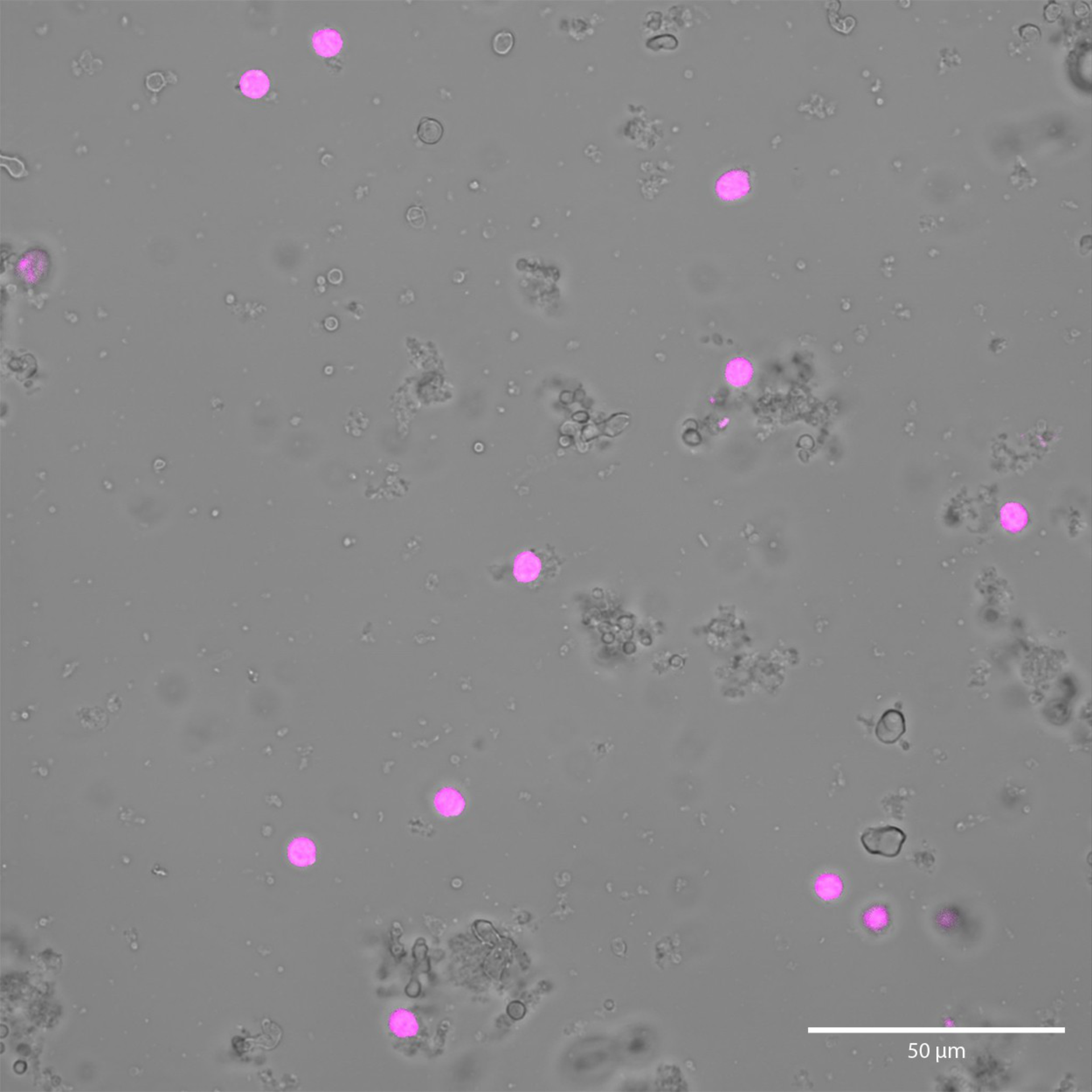 Preparation of single cell suspension from tissue | Genomic analysis ...