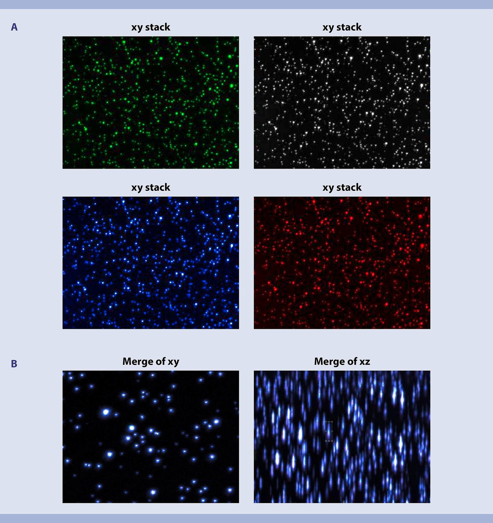 LightSpeed Mode for UltraMicroscope Blaze™ – Faster than ever, precise ...