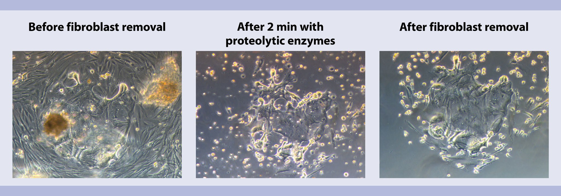 Initiation of human tumor cell culture from primary tumors | Miltenyi ...