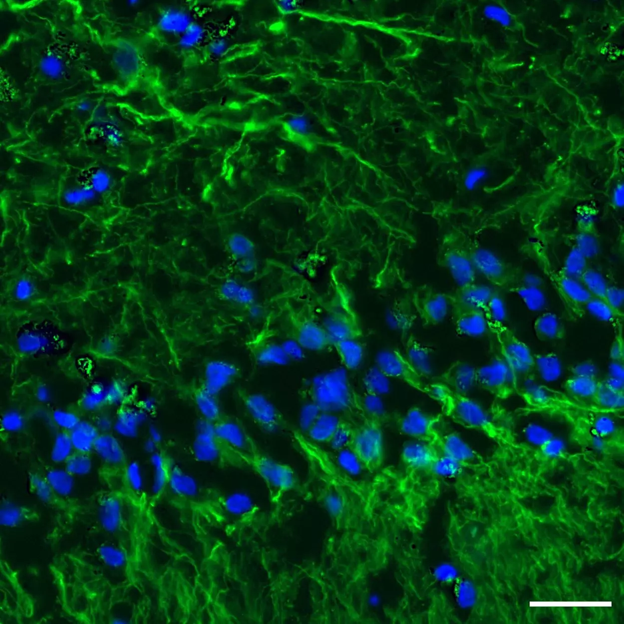 MAP2 Antibody, anti-human, REAdye_lease™ | Miltenyi Biotec | USA