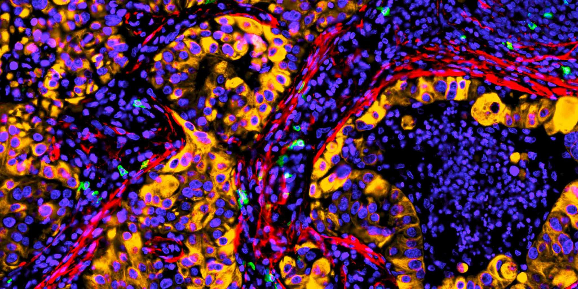 Spatial biology and imaging | Miltenyi Biotec | Great Britain