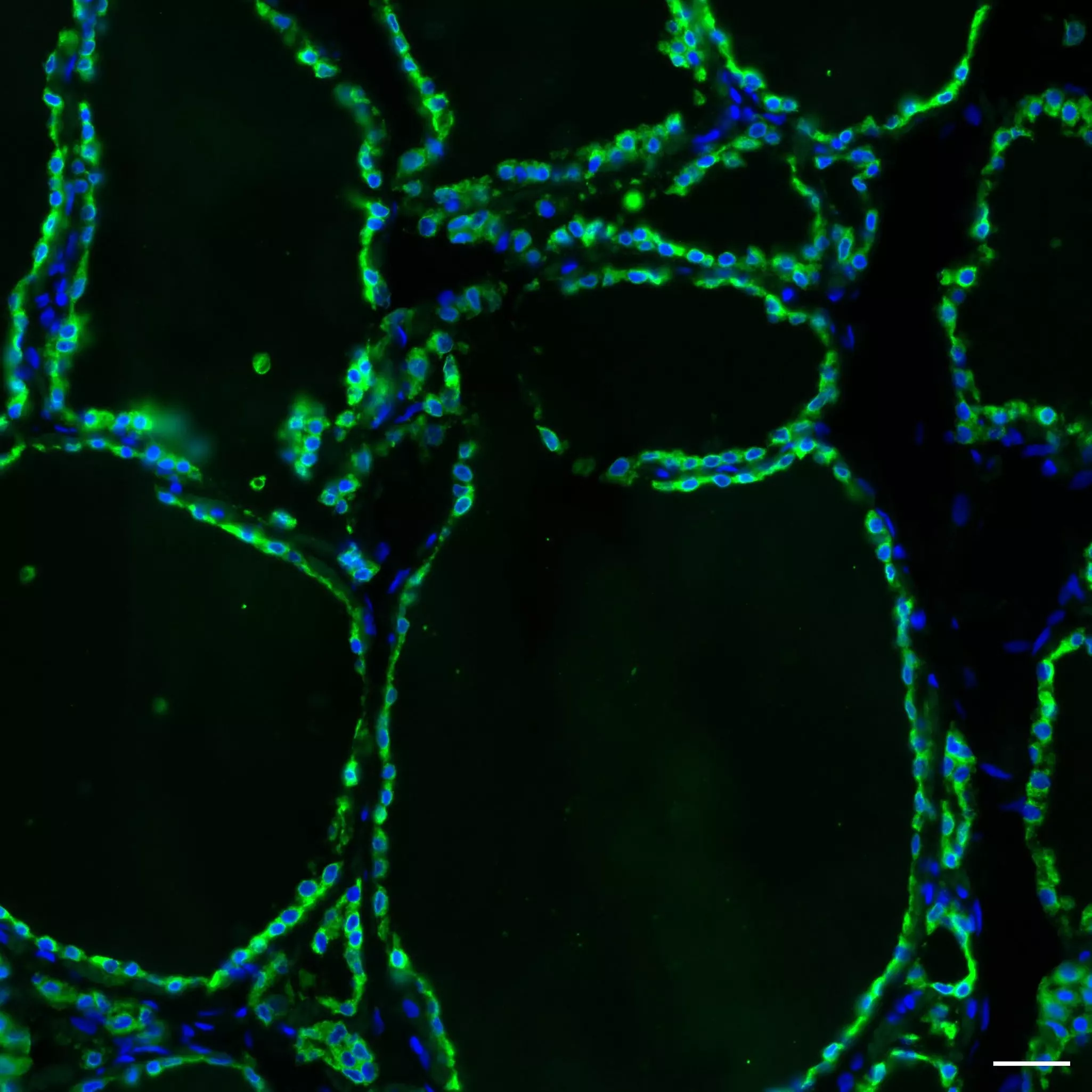 Thyroid Peroxidase Antibody, anti-human, REAfinity™ | Miltenyi Biotec ...