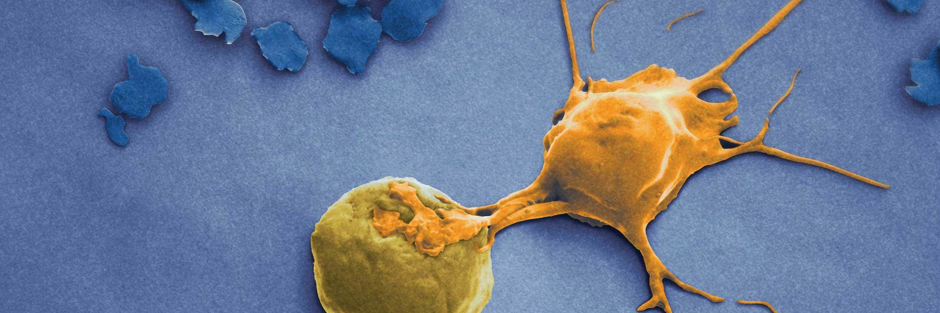 NK cell expansion | NK cell isolation | Miltenyi | Miltenyi Biotec | USA