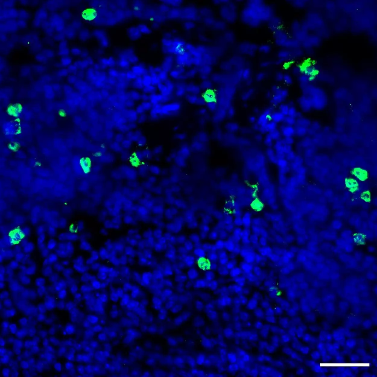 Siglec-F Antibody, anti-mouse, REAlease® | Miltenyi Biotec | 대한민국
