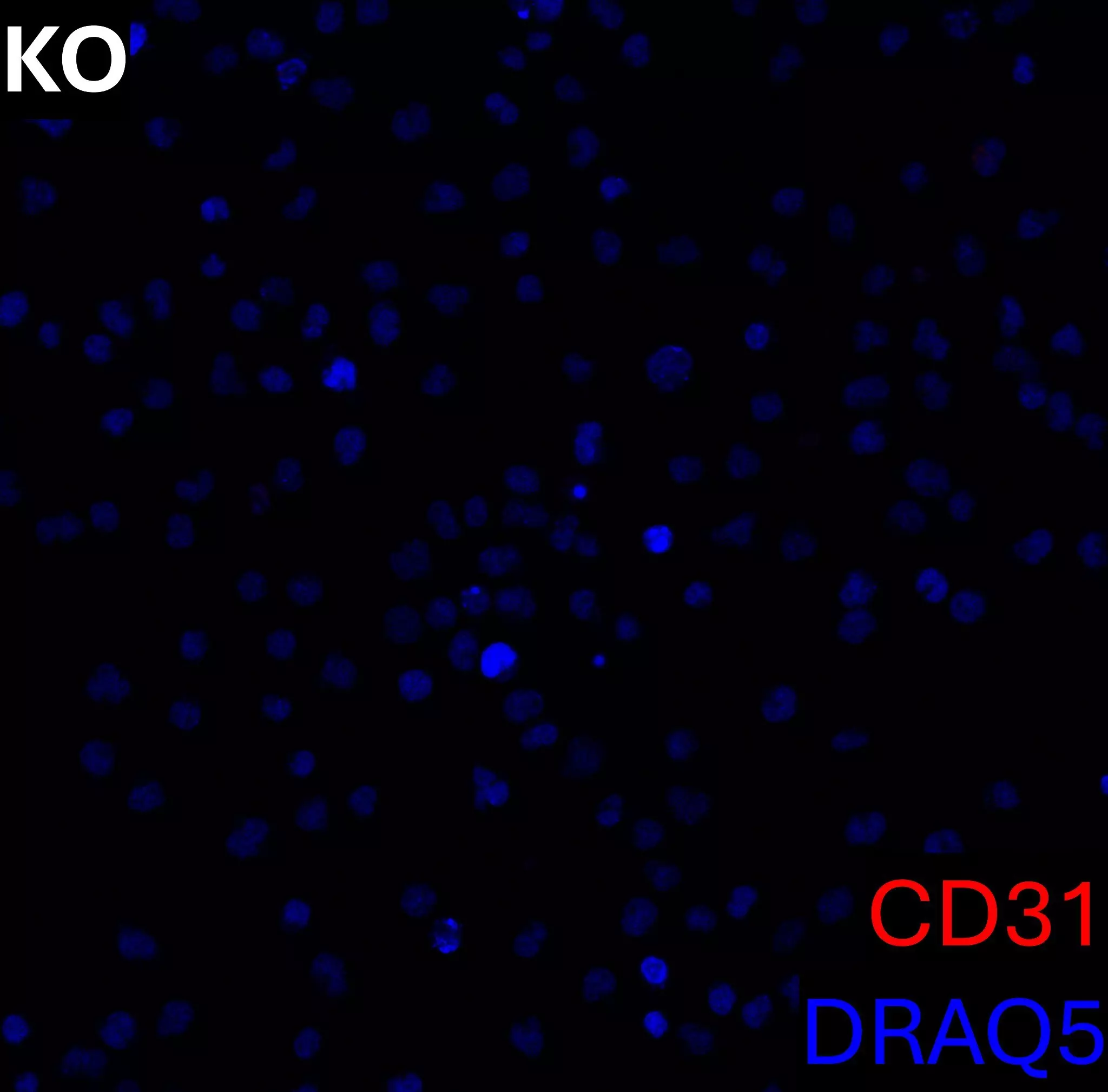 CD31 Antibody, anti-human, REAfinity™ | Miltenyi Biotec | Great Britain