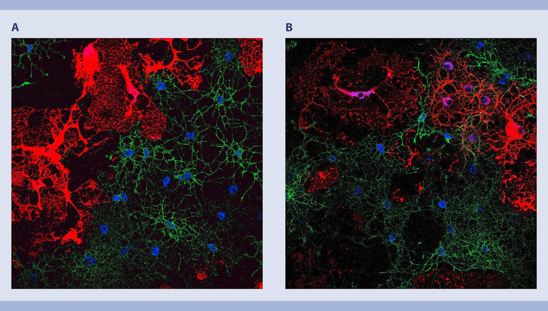 Neural cells (mouse) | Miltenyi Biotec | Australia