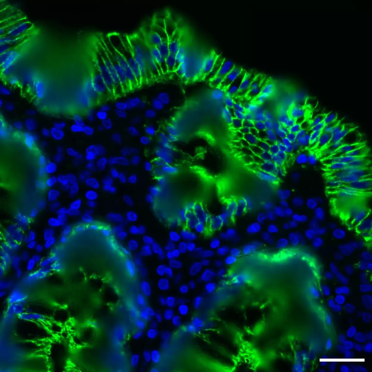 CD324 (E-Cadherin) Antibody, anti-human, REAfinity™ | Miltenyi Biotec ...