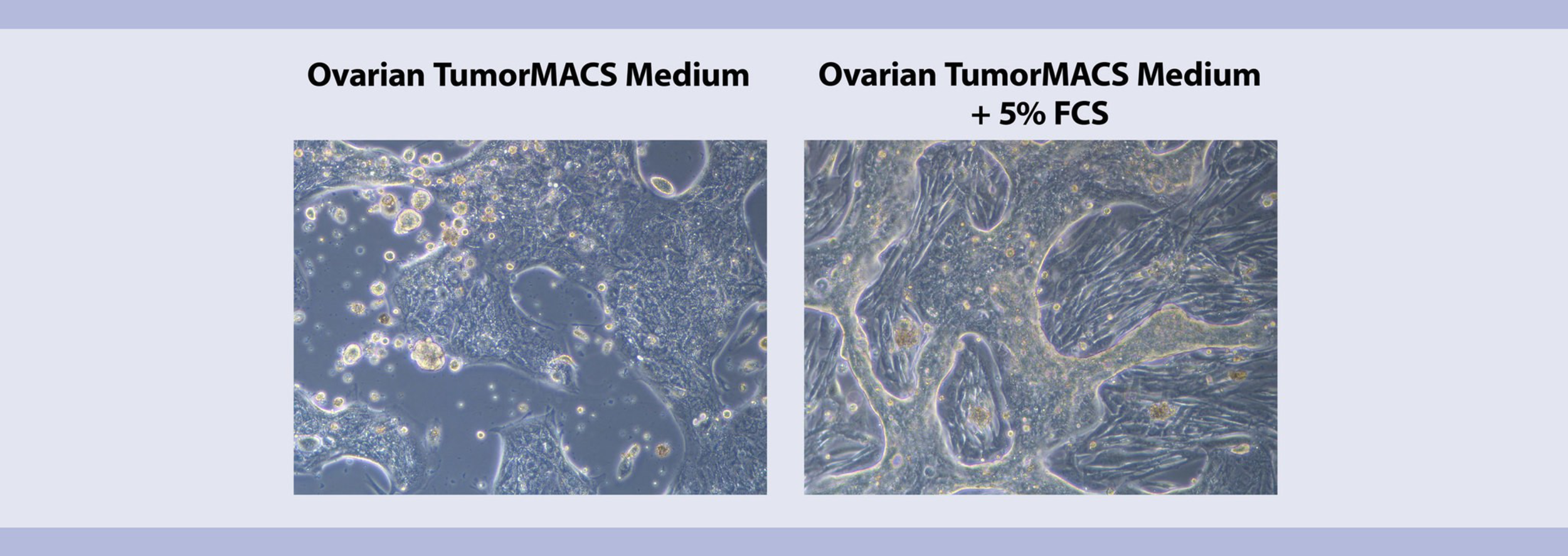 Initiation of human tumor cell culture from primary tumors | Miltenyi ...