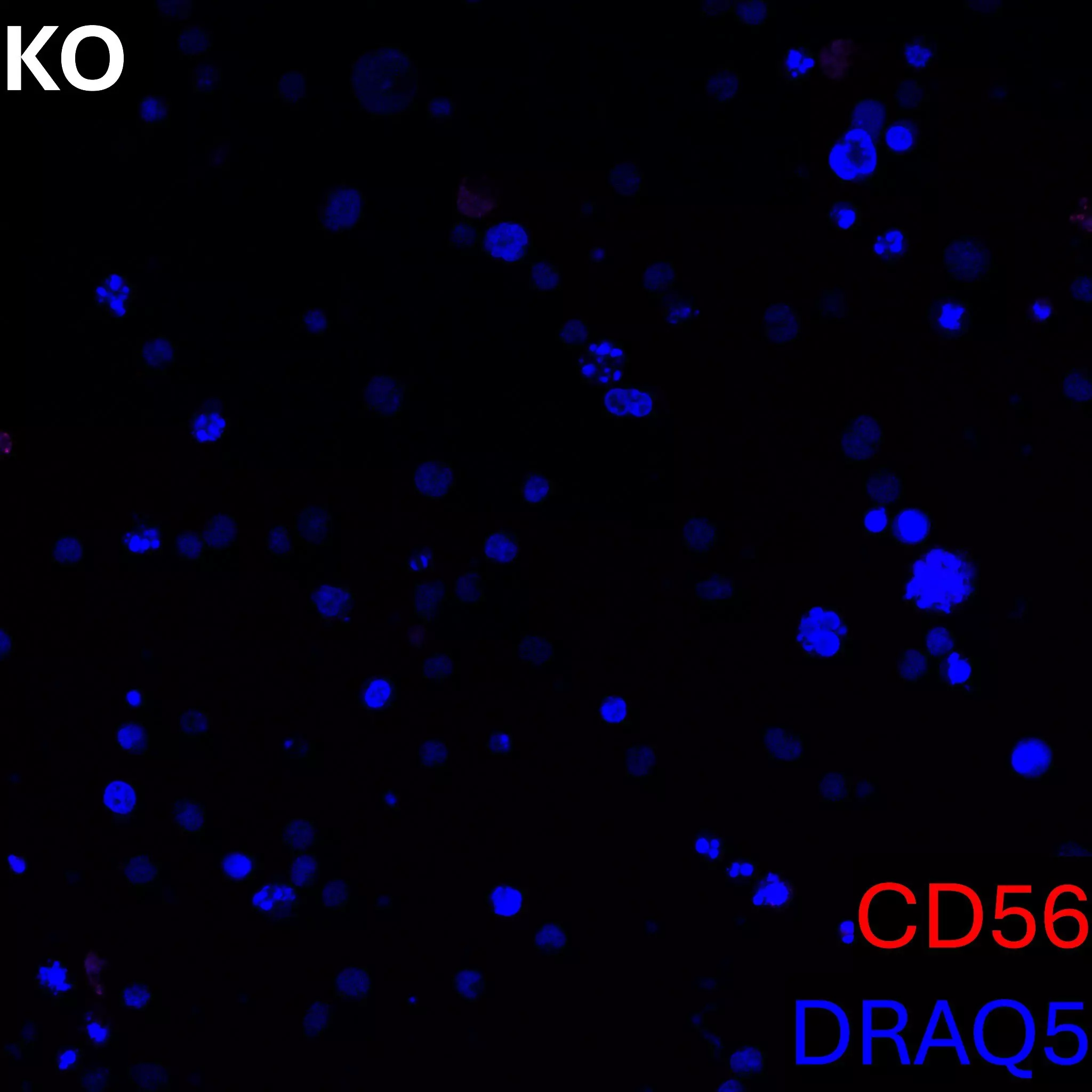 CD56 Antibody, anti-human, REAfinity™ | Miltenyi Biotec | USA