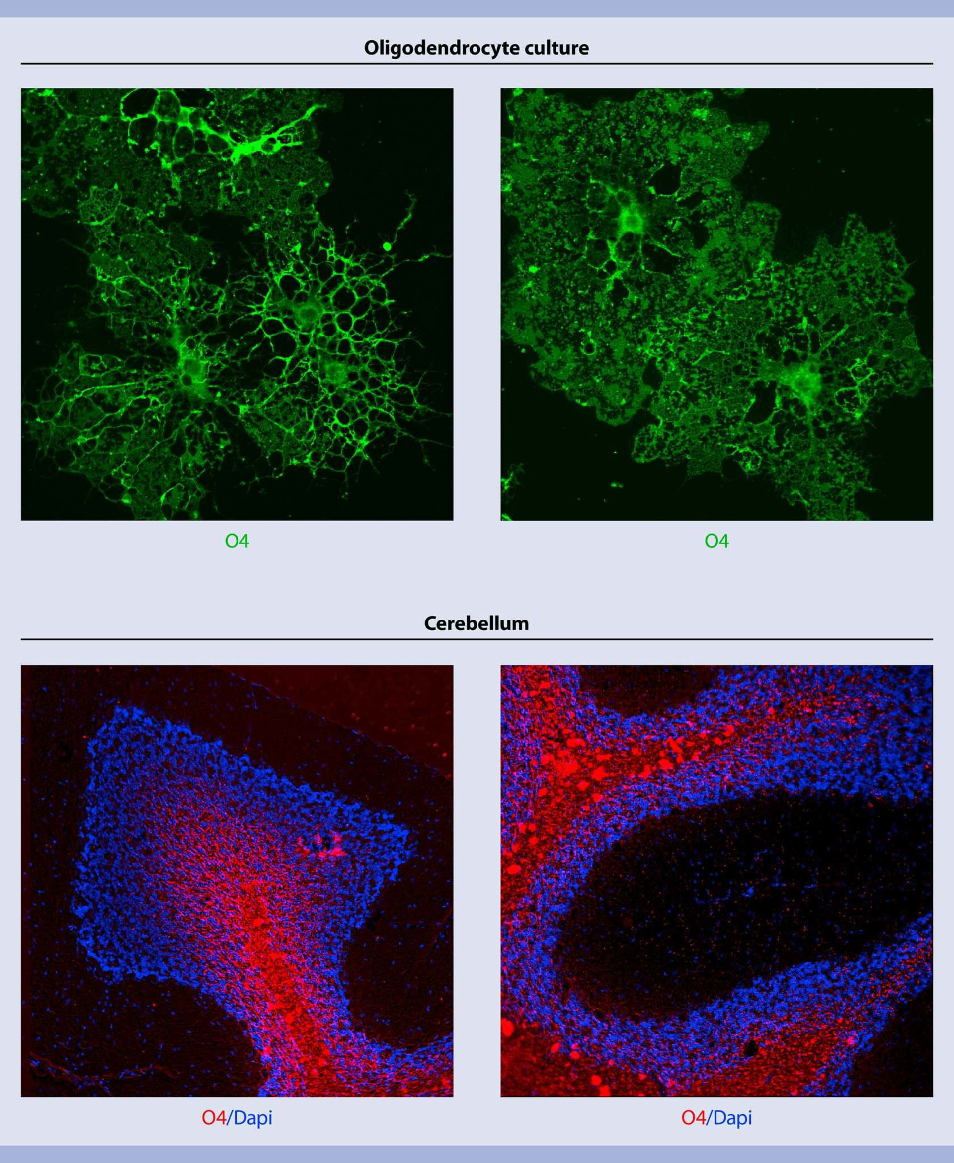 Isolation, characterization, and cultivation of oligodendrocytes ...