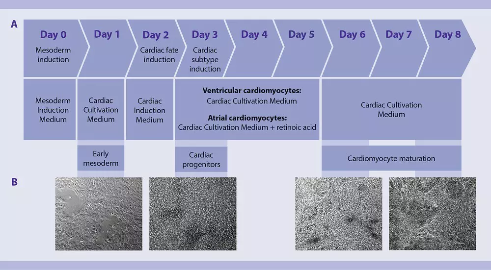 Cardiomyocyte differentiation from PSCs | Workflow solutions | Miltenyi ...
