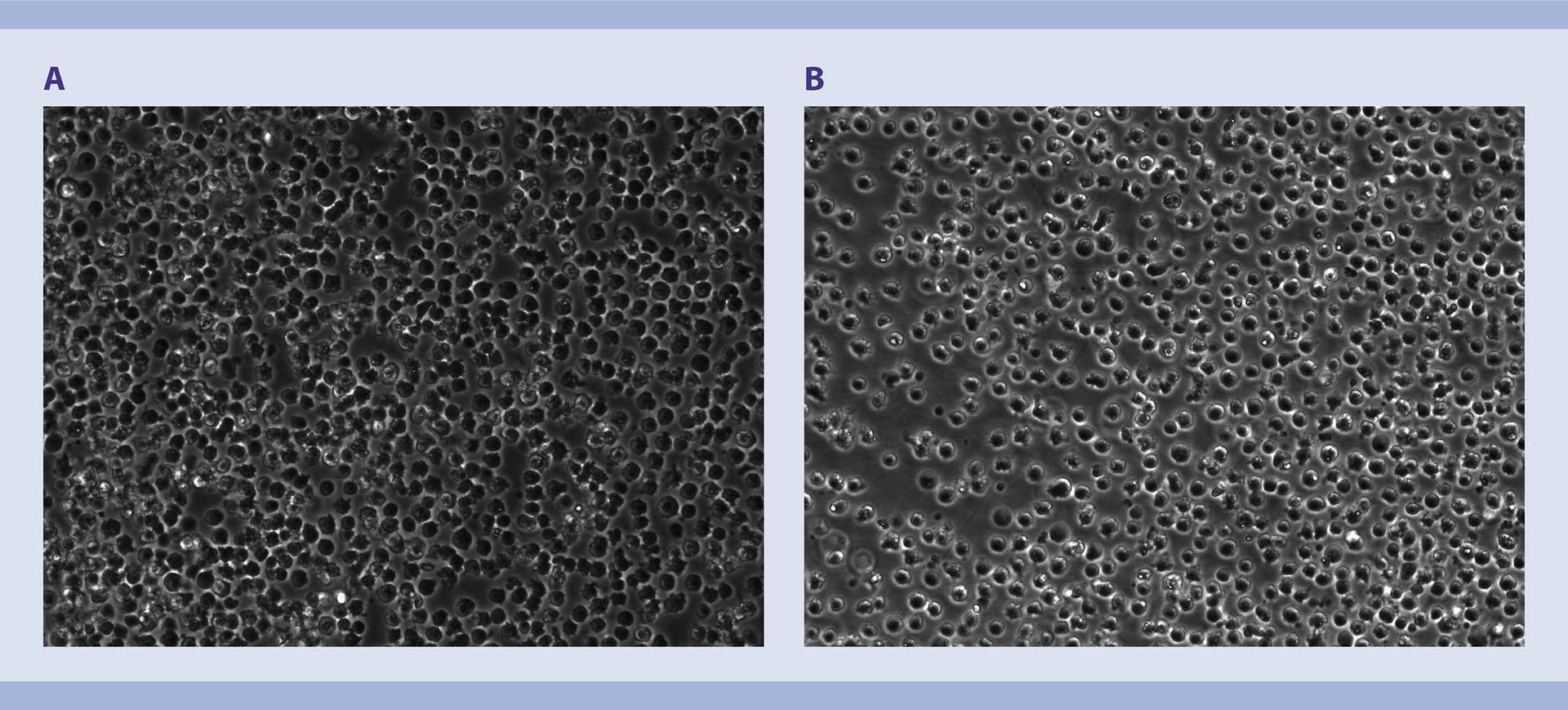 PSC-derived cerebral organoids | Protocol | Miltenyi Biotec | USA