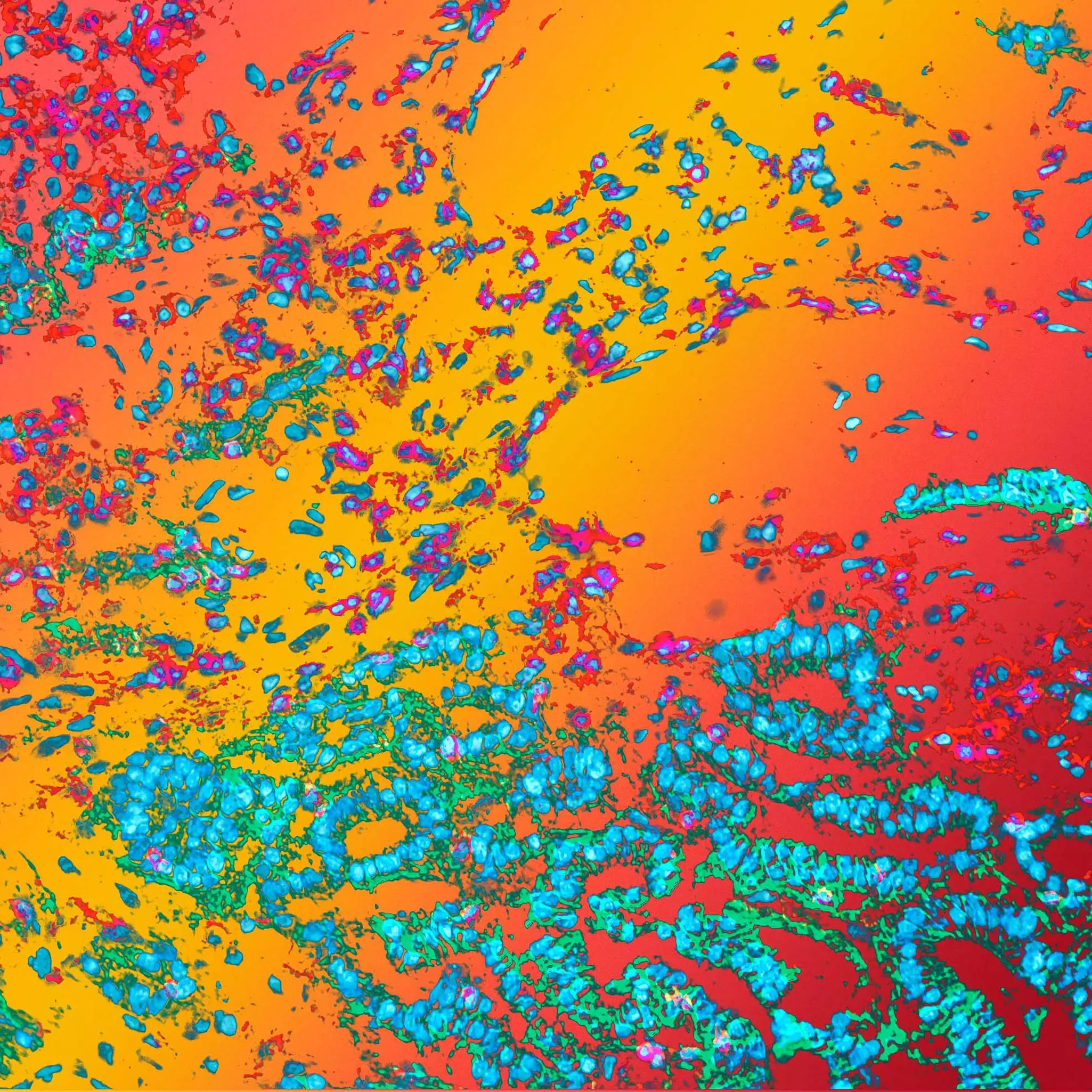 Spatial biology | MACSima™ Platform | Multiplex Imaging | Miltenyi ...