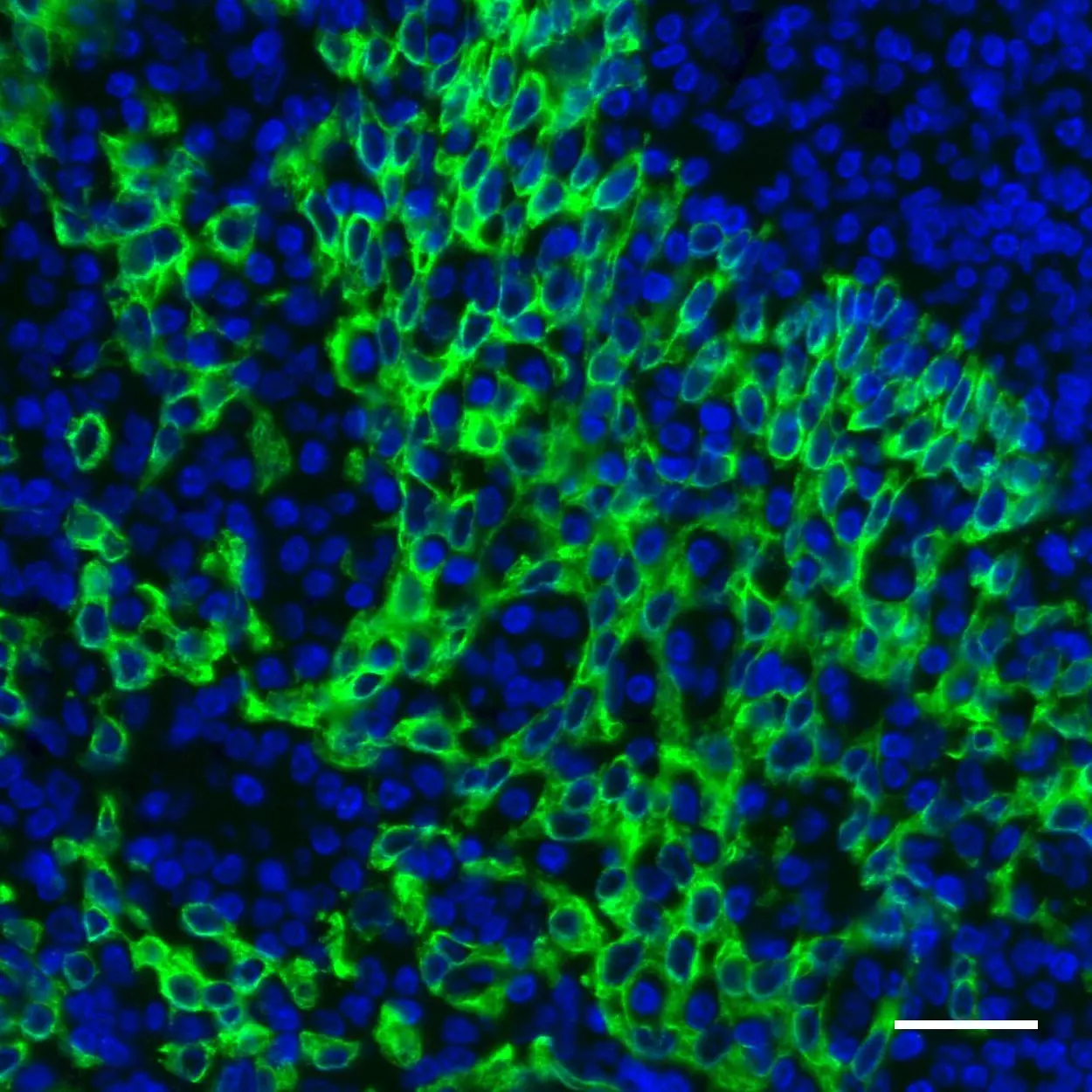CD366 (TIM-3) Isoform 2 Antibody, anti-human, REAdye_lease™ | Miltenyi ...