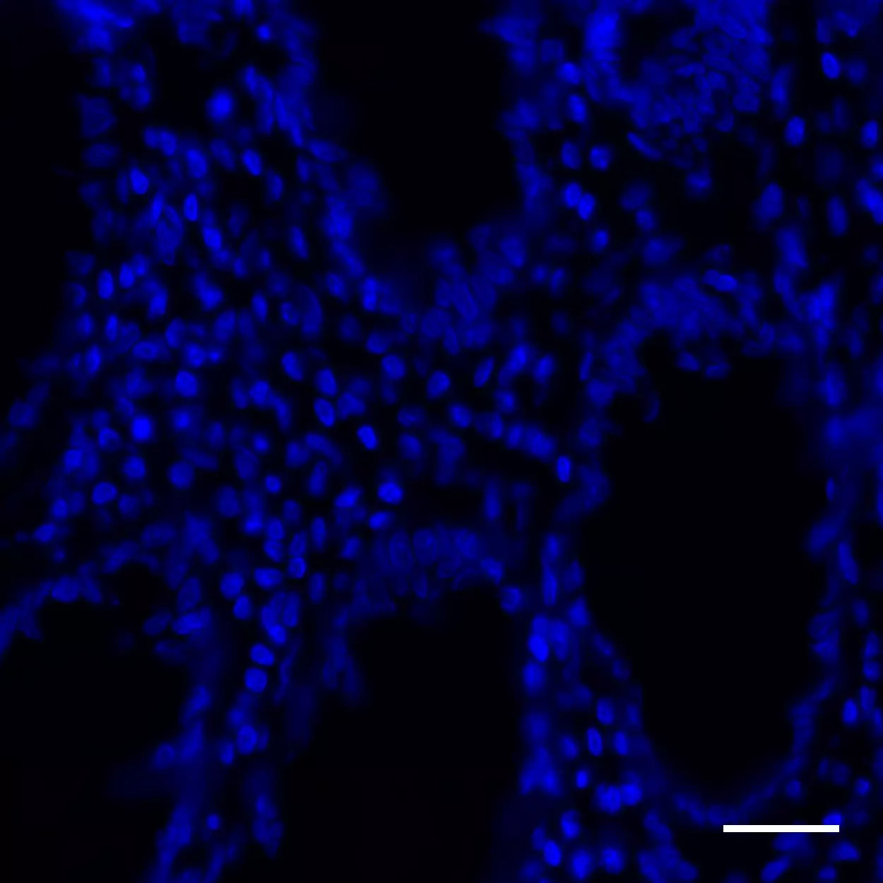 CD183 (CXCR3) Antibody, anti-human, REAdye_lease™ | Miltenyi Biotec ...