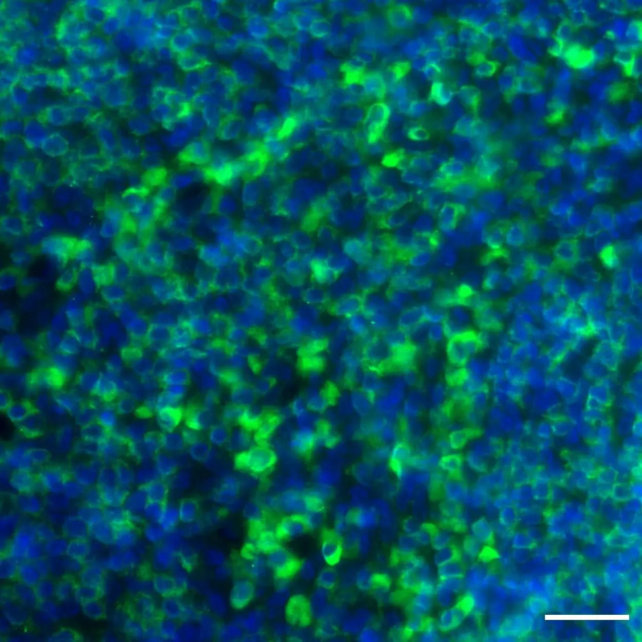 CD79a Antibody, anti-human, REAfinity™ | Miltenyi Biotec | USA