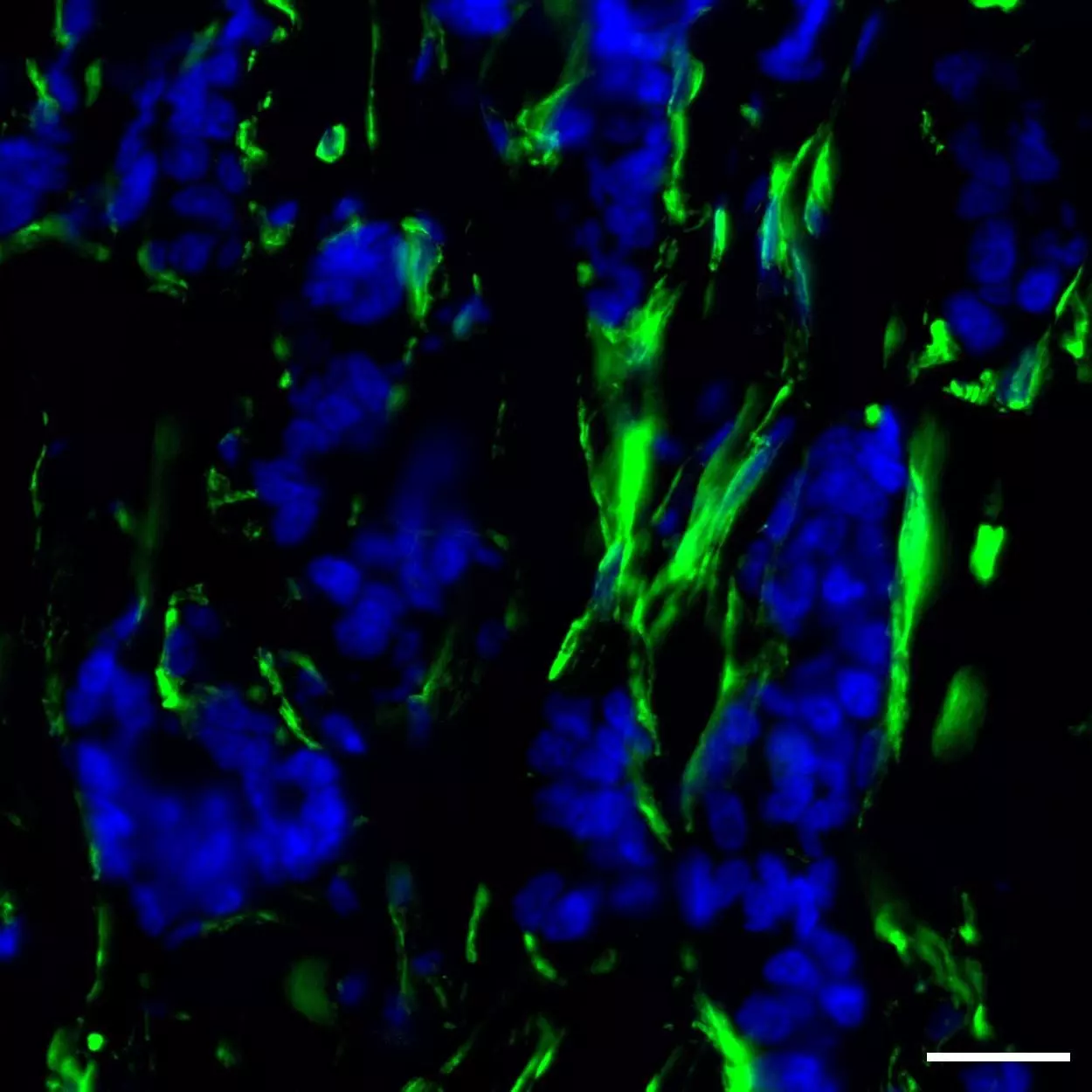 Actin (Smooth Muscle) Antibody, anti-human, REAdye_lease™ | Miltenyi ...