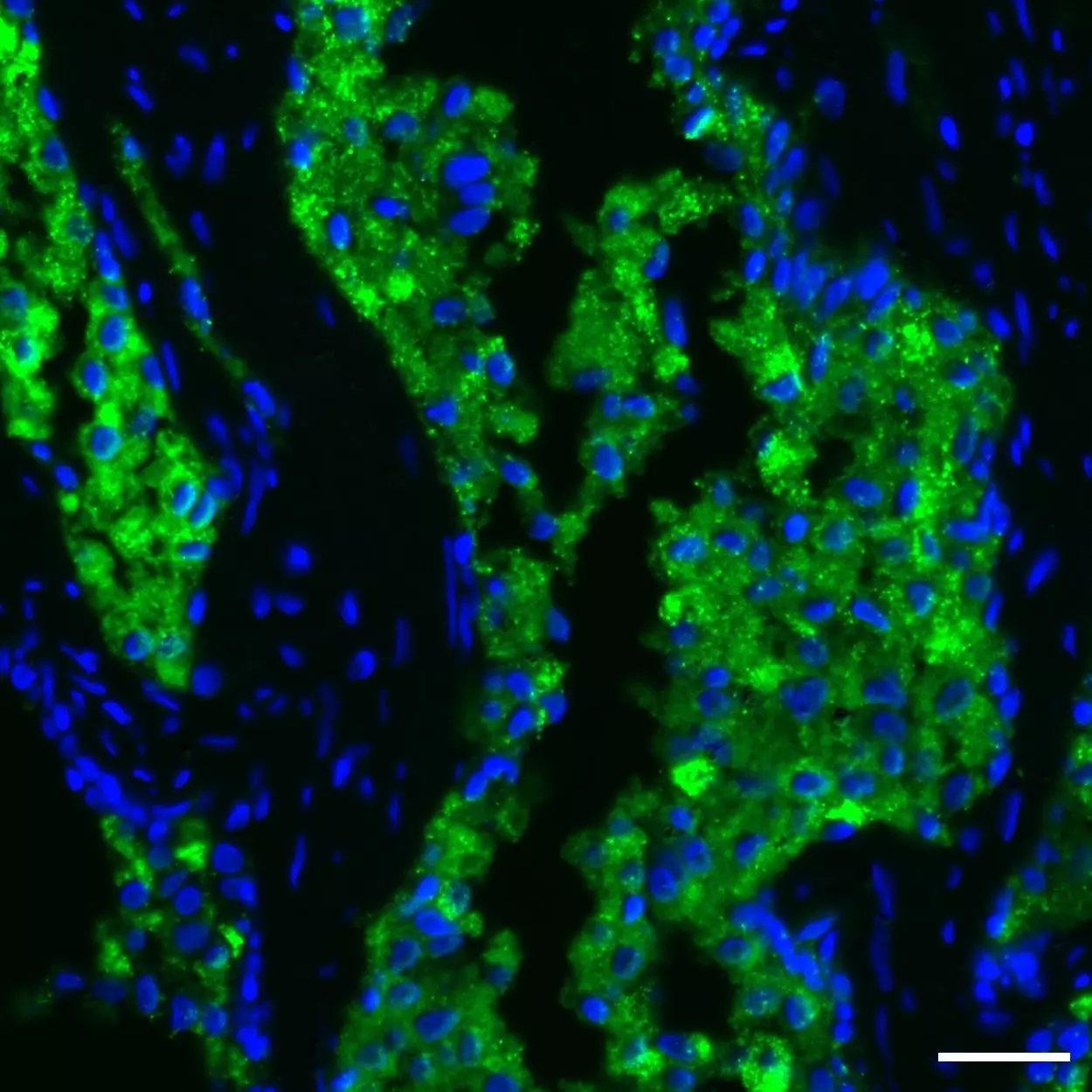 Prostate-specific antigen Antibody, anti-human, REAdye_lease ...