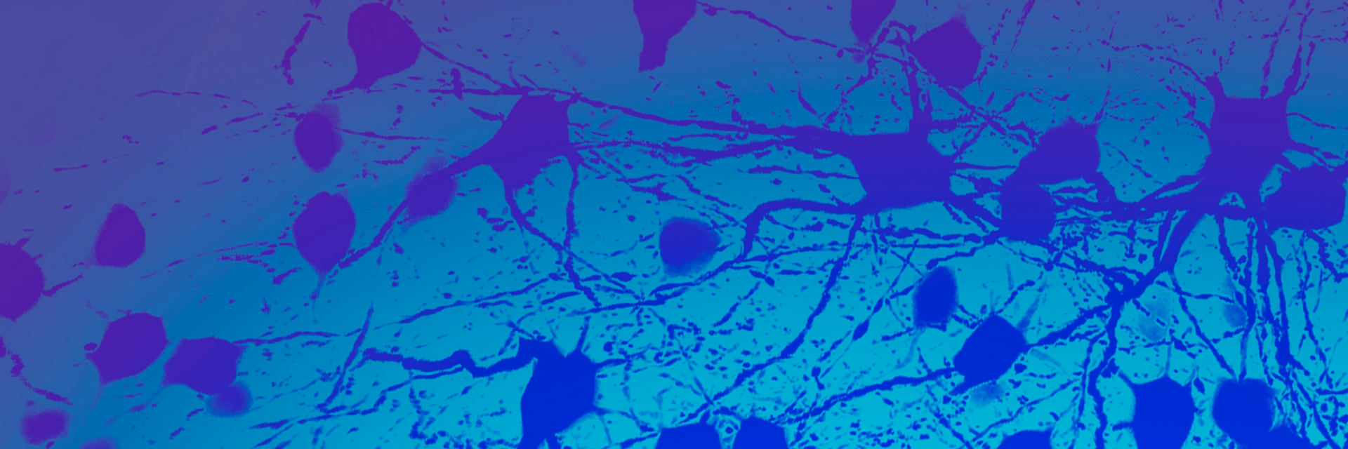 Astrocytes | Astrocyte Culture Isolation Characterization ...