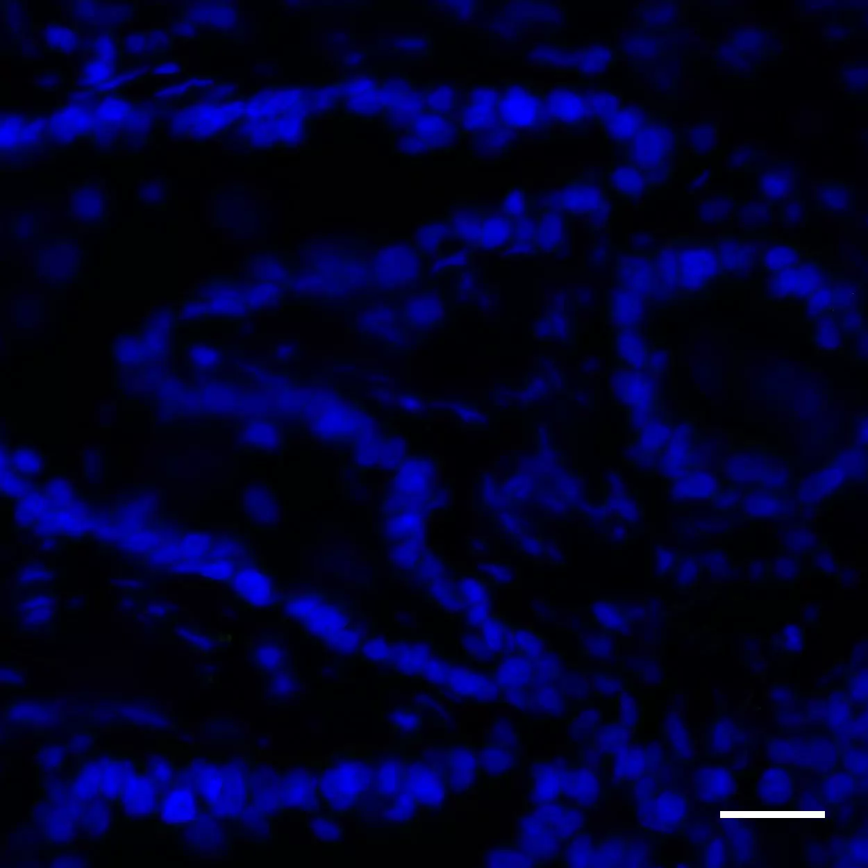 Mucin-5AC Antibody, anti-human, REAdye_lease™ | Miltenyi Biotec ...