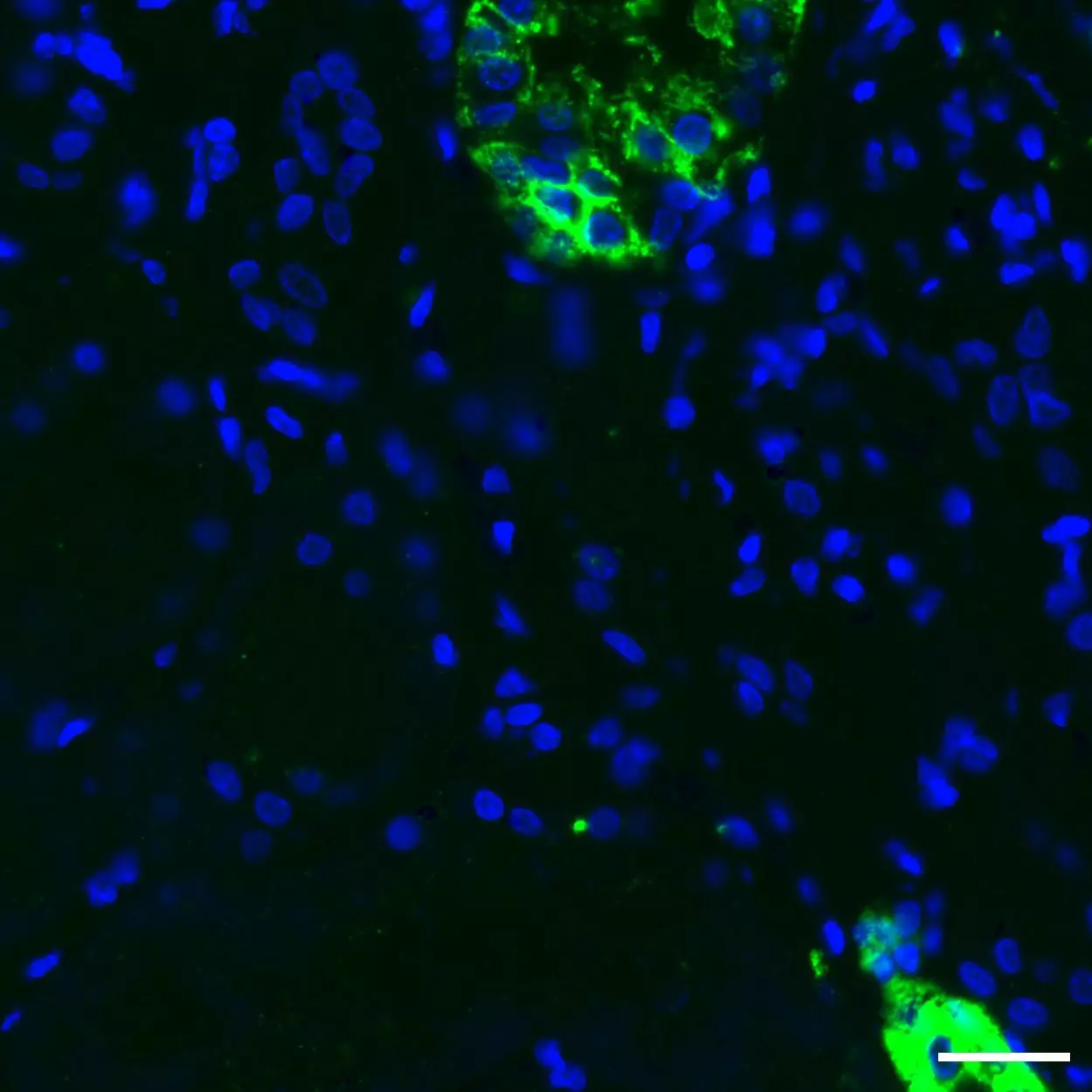 CD171 (L1CAM) Antibody, anti-human, REAdye_lease™ | Miltenyi Biotec ...