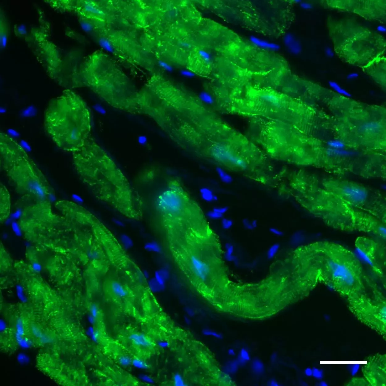 Calsequestrin 2 Antibody, anti-human, REAdye_lease™ | Miltenyi Biotec | USA