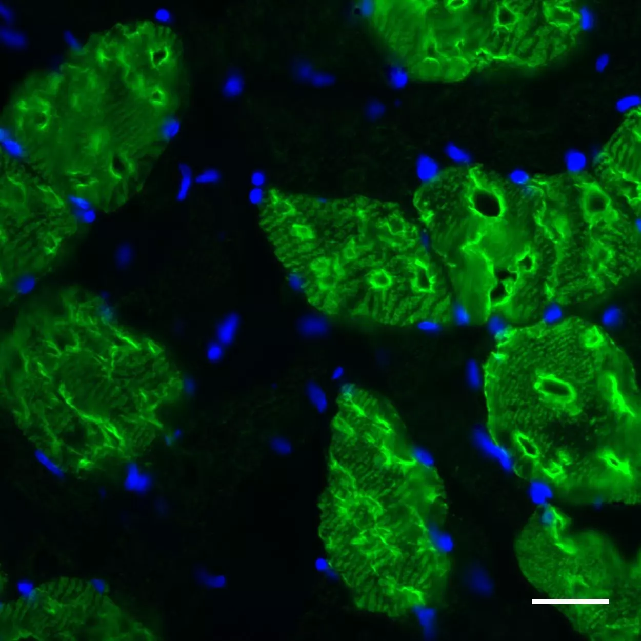 MYH7B Antibody, anti-human, REAdye_lease™ | Miltenyi Biotec | USA