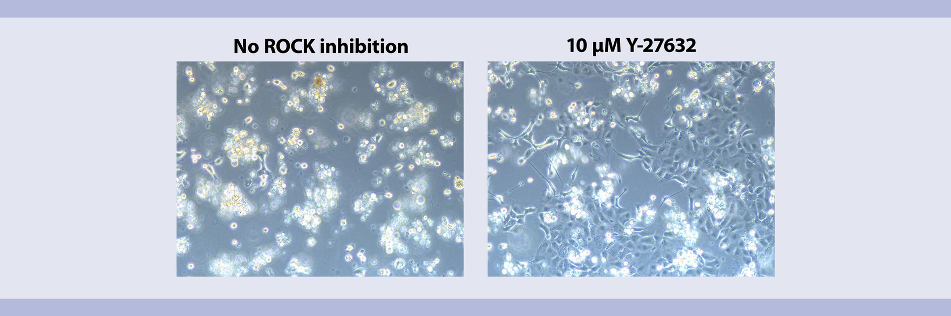 Initiation of human tumor cell culture from primary tumors | Miltenyi ...