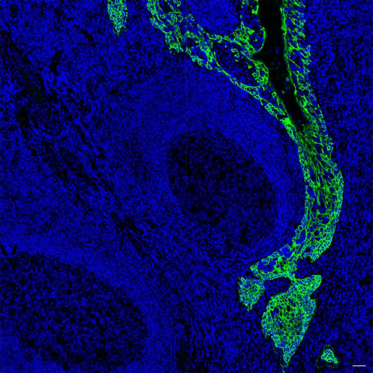 Cytokeratin LMW Antibody, anti-human, REAfinity™ | Miltenyi Biotec | 日本