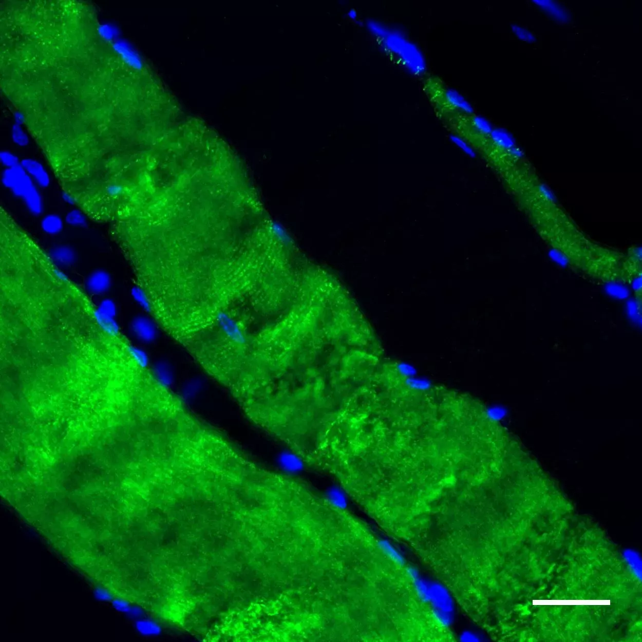 MYH7B Antibody, anti-human, REAdye_lease™ | Miltenyi Biotec | USA