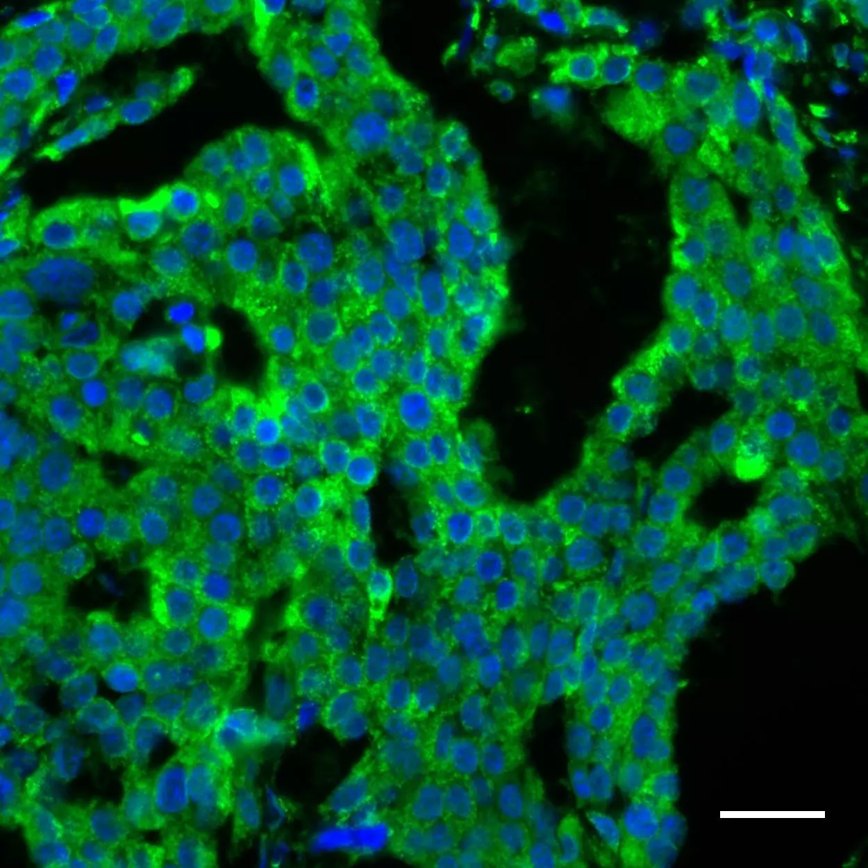 ErbB-2 (HER2) Antibody, anti-human, REAfinity™ | Miltenyi Biotec | USA