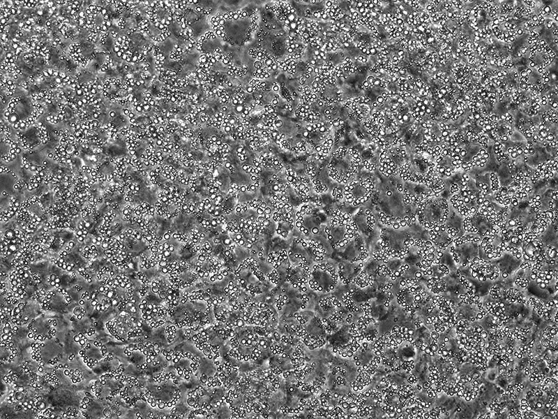 Adipose Tissue Progenitor Isolation Kit, mouse | Miltenyi Biotec | 日本