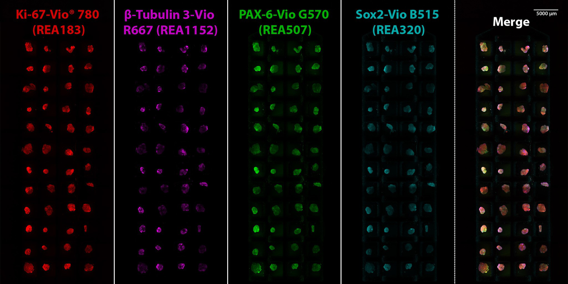 LightSpeed Mode for UltraMicroscope Blaze™ – Faster than ever, precise ...