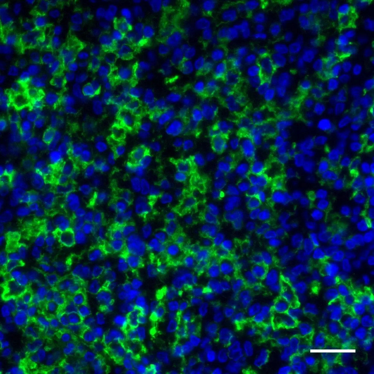 CD16 Antibody, anti-human, REAfinity™ | Miltenyi Biotec | 대한민국