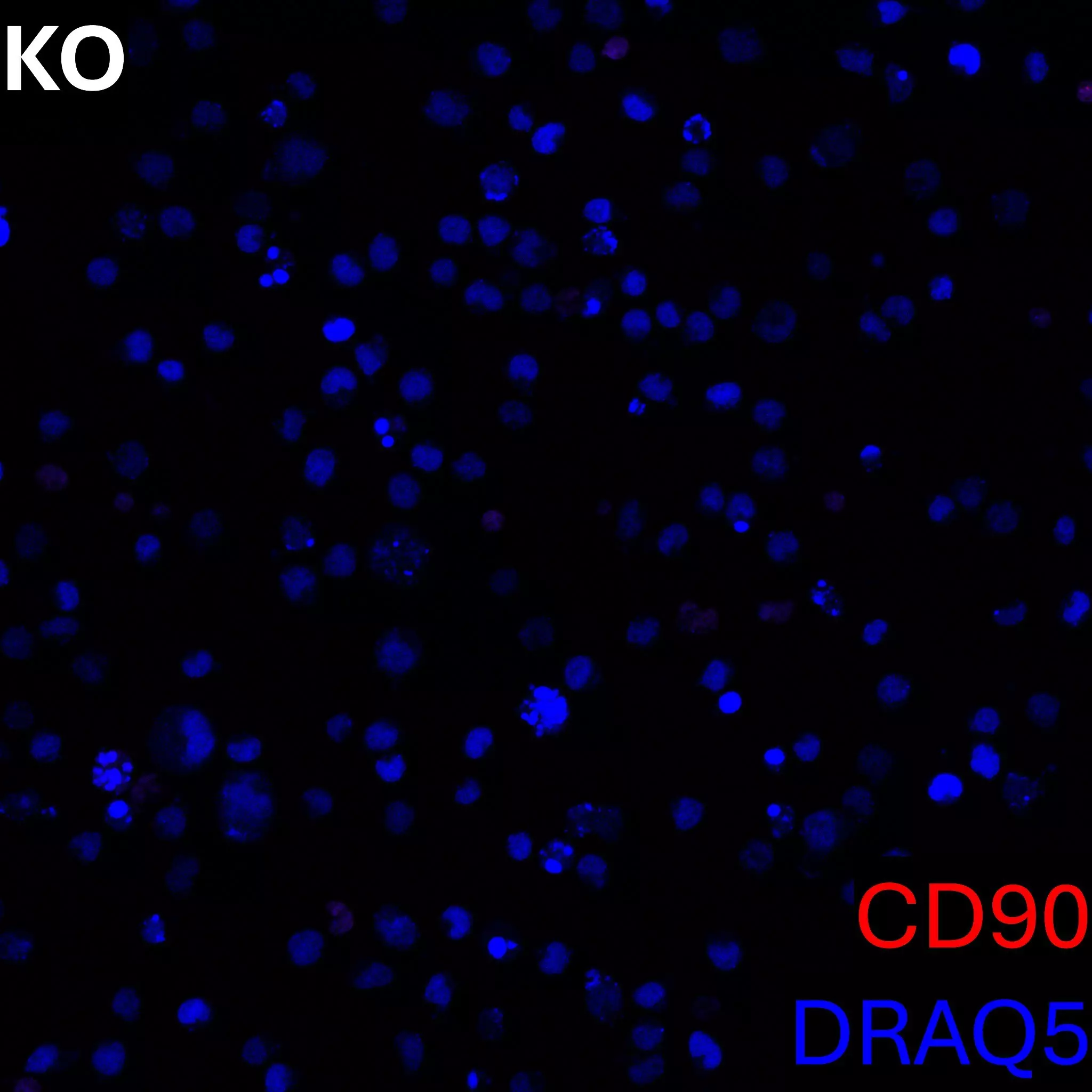 CD90 Antibody, anti-human, REAfinity™ | Miltenyi Biotec | USA