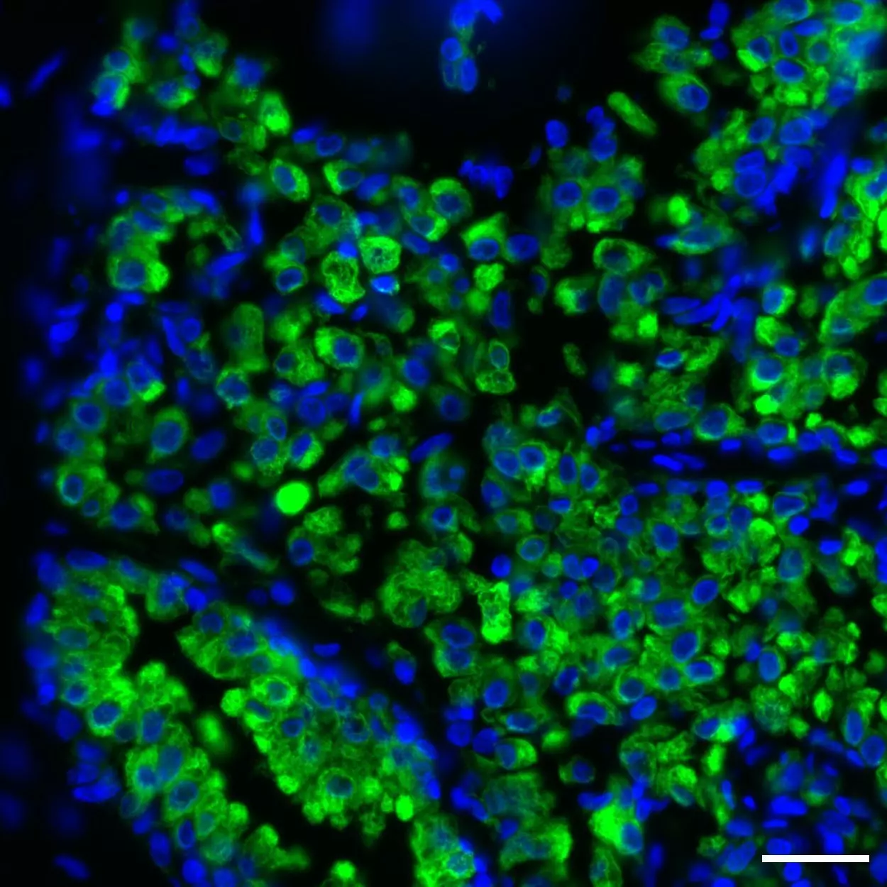 Cytokeratin 8/18 Antibody, anti-human, REAdye_lease™ | Miltenyi Biotec ...