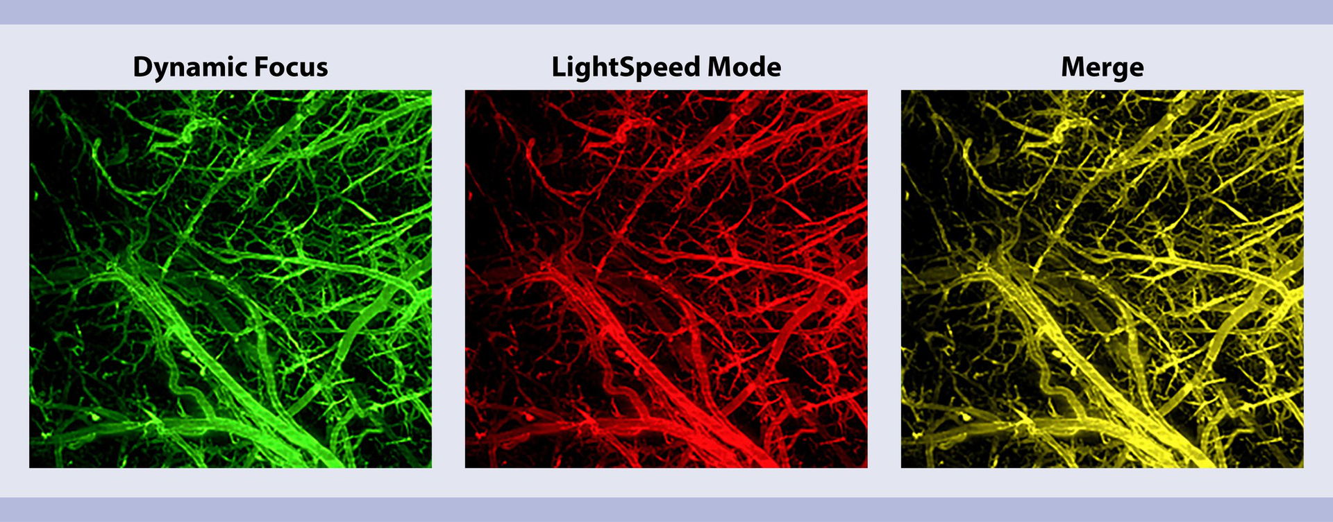 LightSpeed Mode for UltraMicroscope Blaze™ – Faster than ever, precise ...