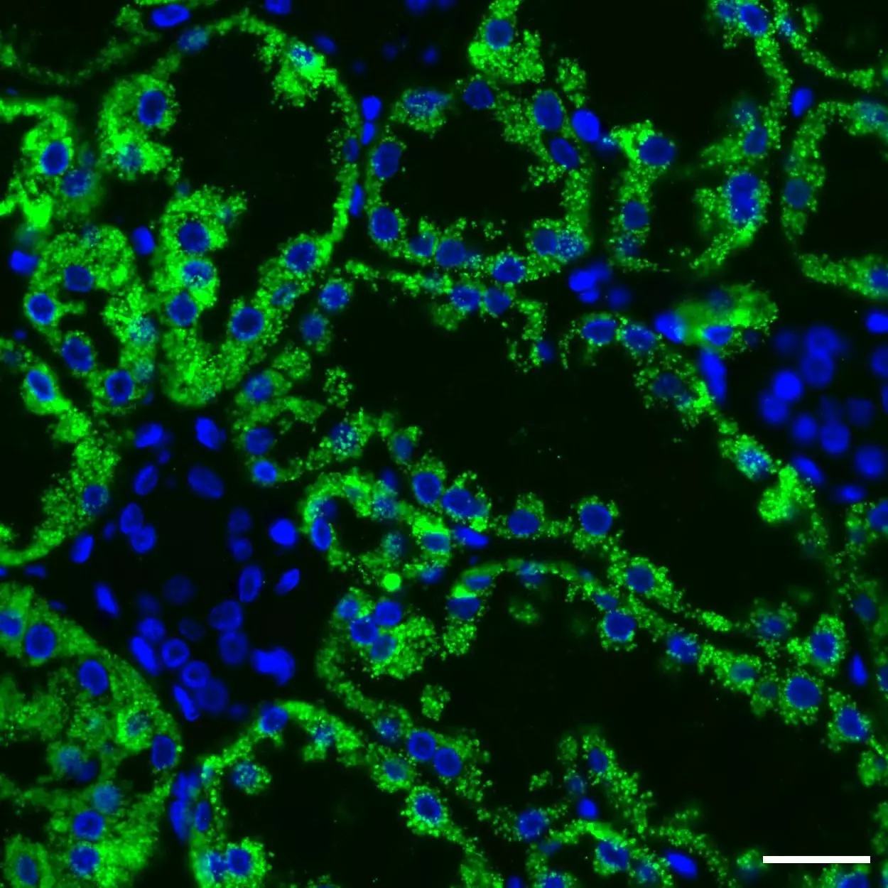 Bcl-XL Antibody, anti-human, REAdye_lease™ | Miltenyi Biotec | Great ...