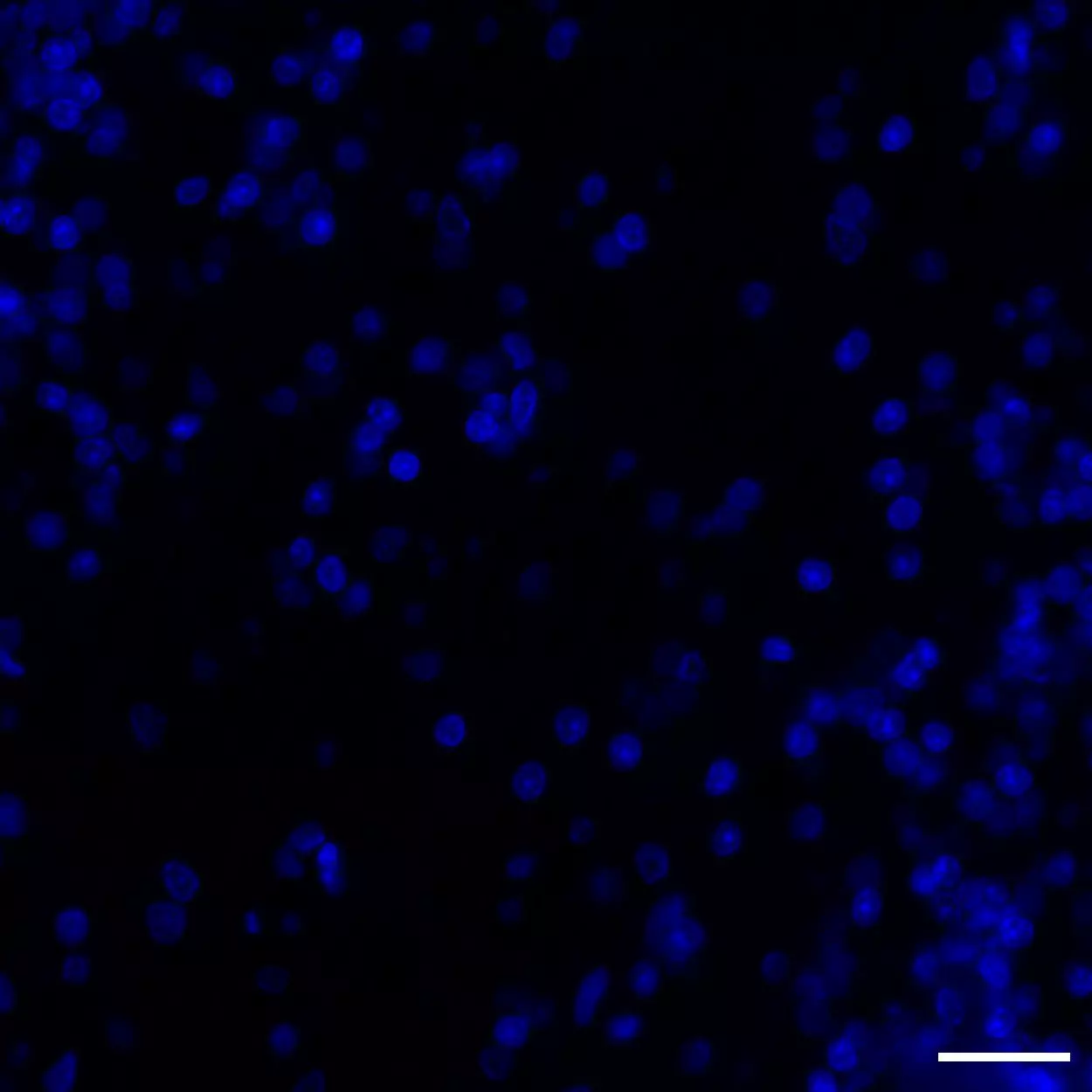 Neurofilament M (160 kD) Antibody, anti-human/mouse, REAdye_lease ...