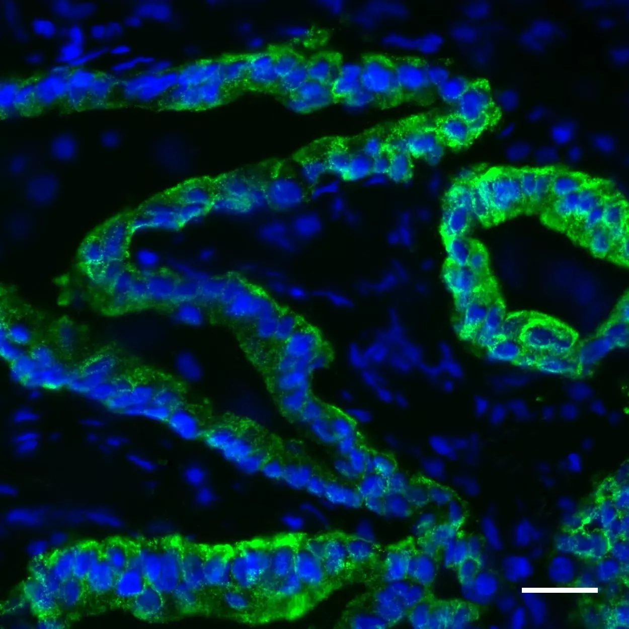 Mucin-5AC Antibody, anti-human, REAdye_lease™ | Miltenyi Biotec ...