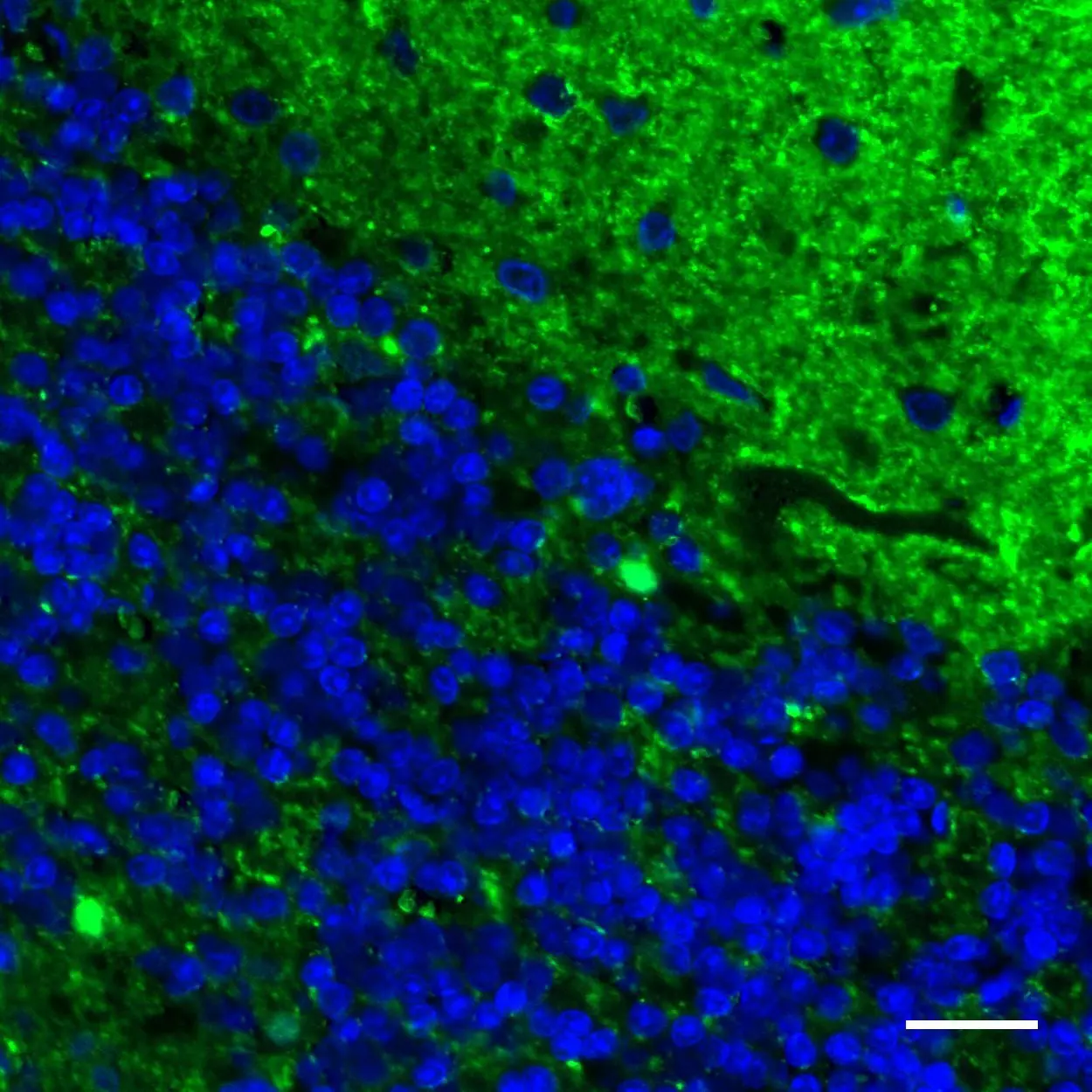 Tau Antibody, anti-human, REAdye_lease™ | Miltenyi Biotec | USA