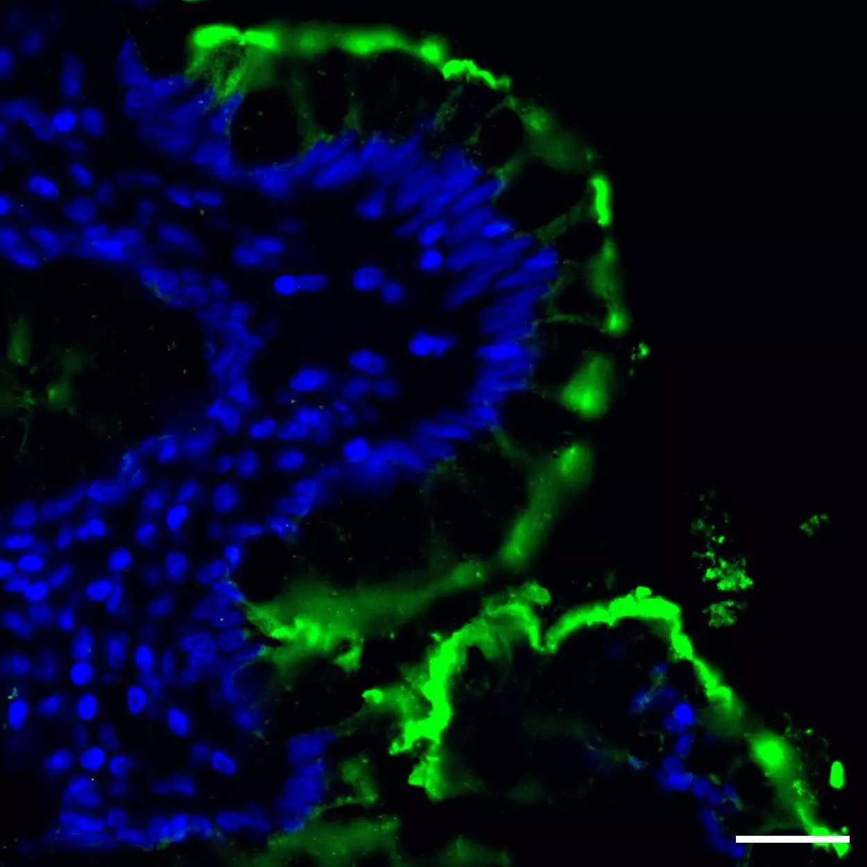 CD66e (CEACAM5) Antibody, anti-human, REAfinity™ | Miltenyi Biotec | USA