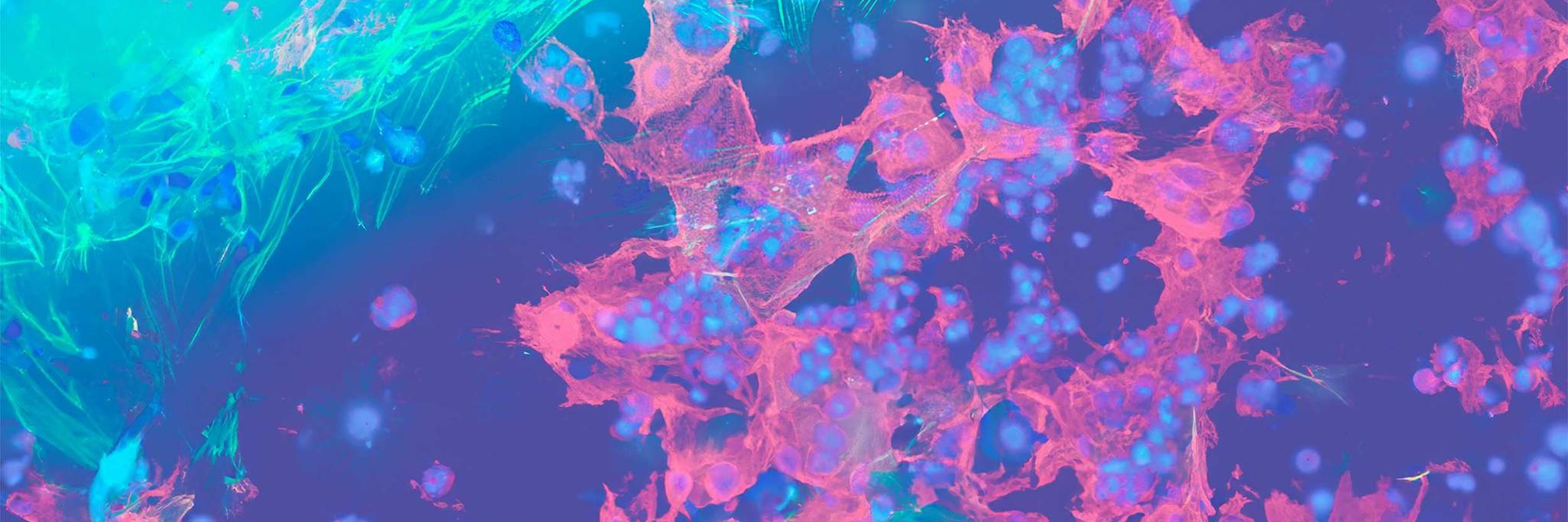 Pluripotent stem cell (PSC) differentiation | Cardiomyocytes | Miltenyi ...