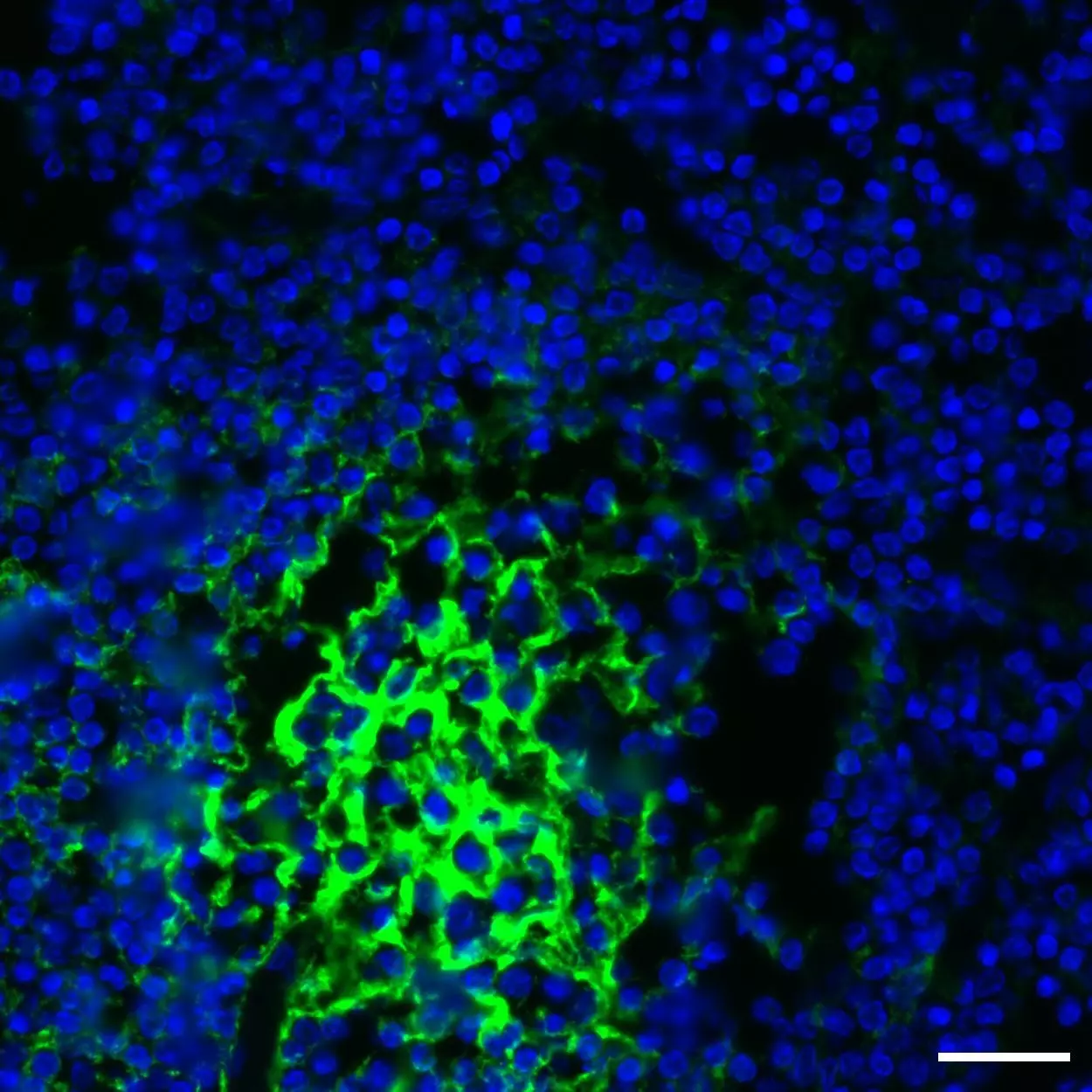 TMEM119 Antibody, anti-human, REAdye_lease™ | Miltenyi Biotec | 中国