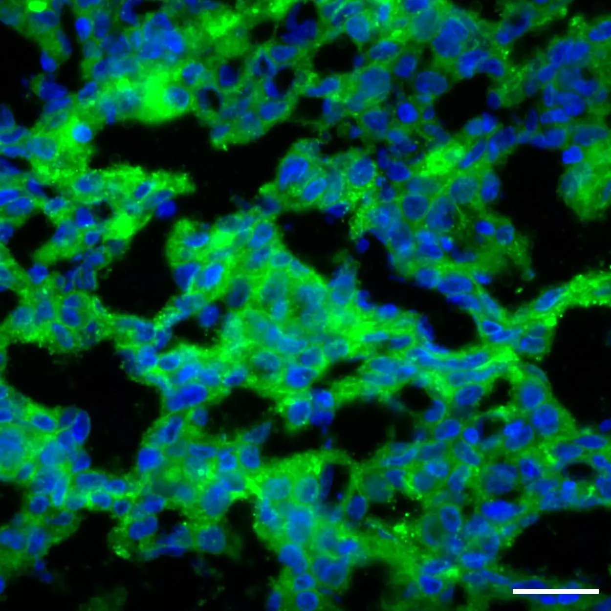 FOLR1 Antibody, anti-human, REAfinity™ | Miltenyi Biotec | Great Britain