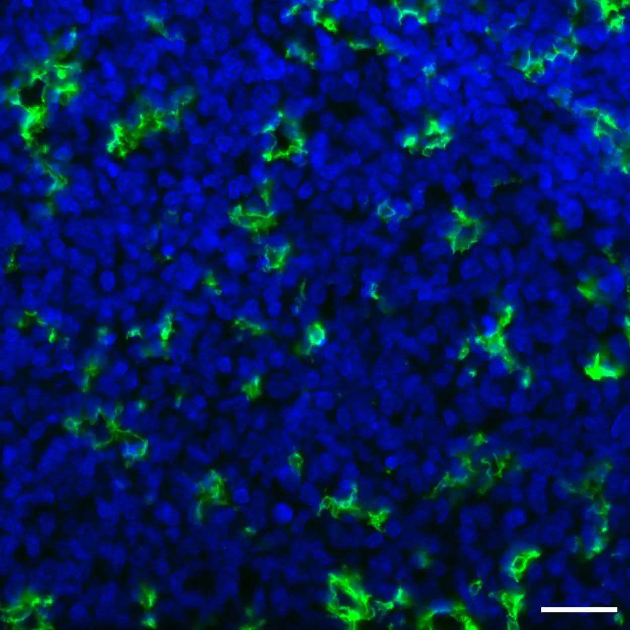 CD11c Antibody, anti-human, REAdye_lease™ | Miltenyi Biotec | USA