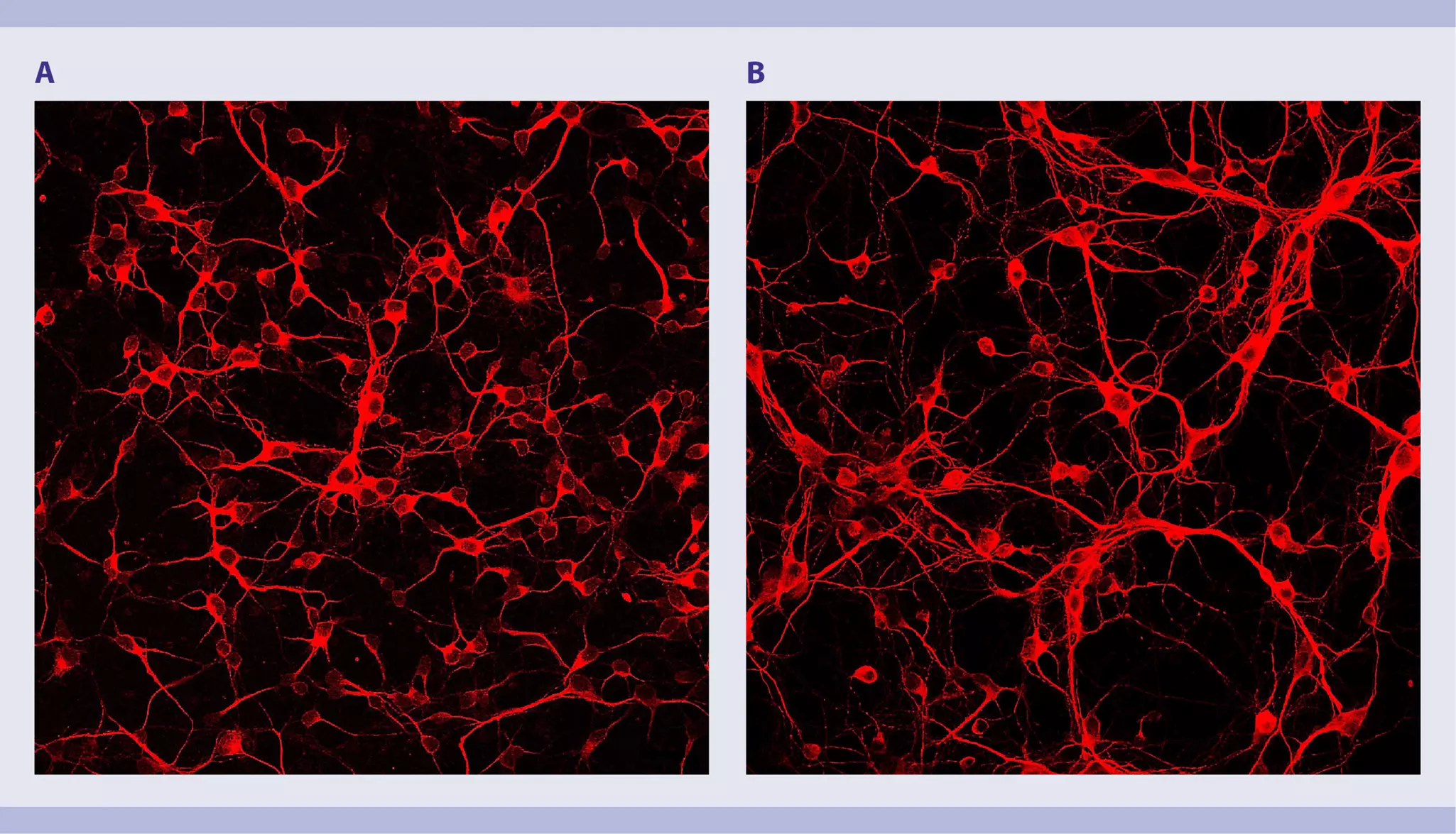 Neurons | Isolation and cultivation | Neonatal mouse brain | Miltenyi ...