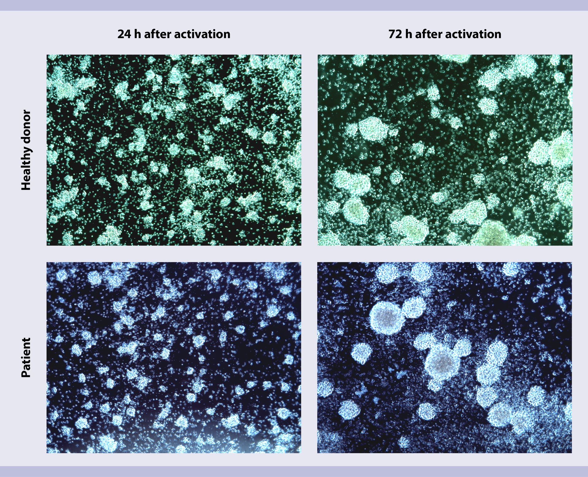 GMP CAR T Cell activation | MACS GMP T Cell TransAct | Miltenyi Biotec ...