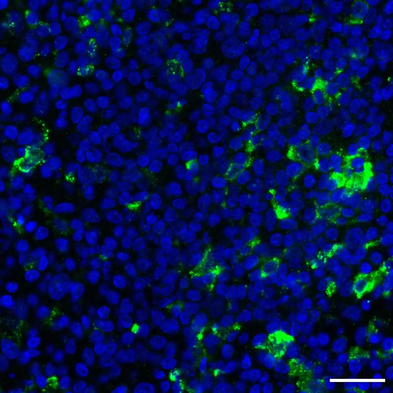 CD11c Antibody, anti-human, REAdye_lease™ | Miltenyi Biotec | USA