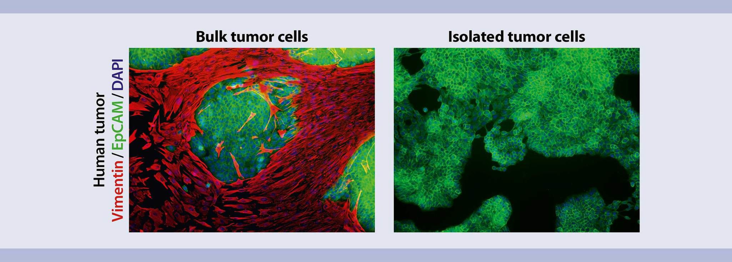 Isolation of tumor cells from human tumor tissue | Protocol | Miltenyi ...